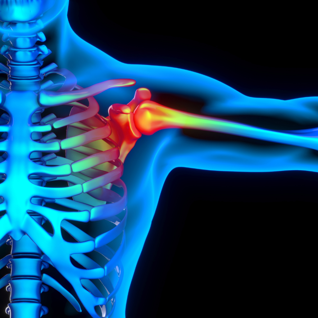 Shoulder Conditions - Premier Orthopedic Specialists of Tulsa